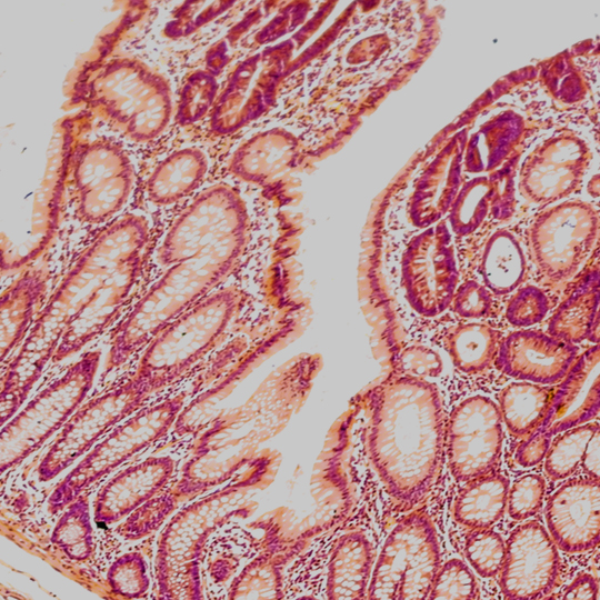 Transforming High-Plex Imaging in Spatial Biology | Market Insights ...